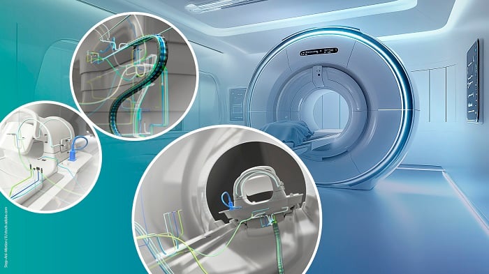 Enhancing image clarity with special MRI coil cabling | Electronics360