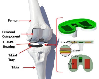 Video: Knee implant sensor generates its own electricity | Electronics360
