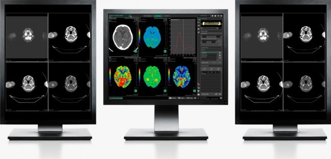 Fujifilm’s AI Aims To Improve Image Reading | Electronics360